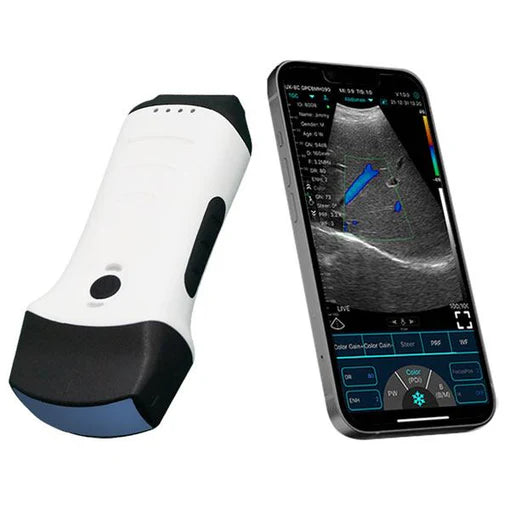 Ecograf ultraportabil wireless C10TX, convex si liniar – Alexa Medical